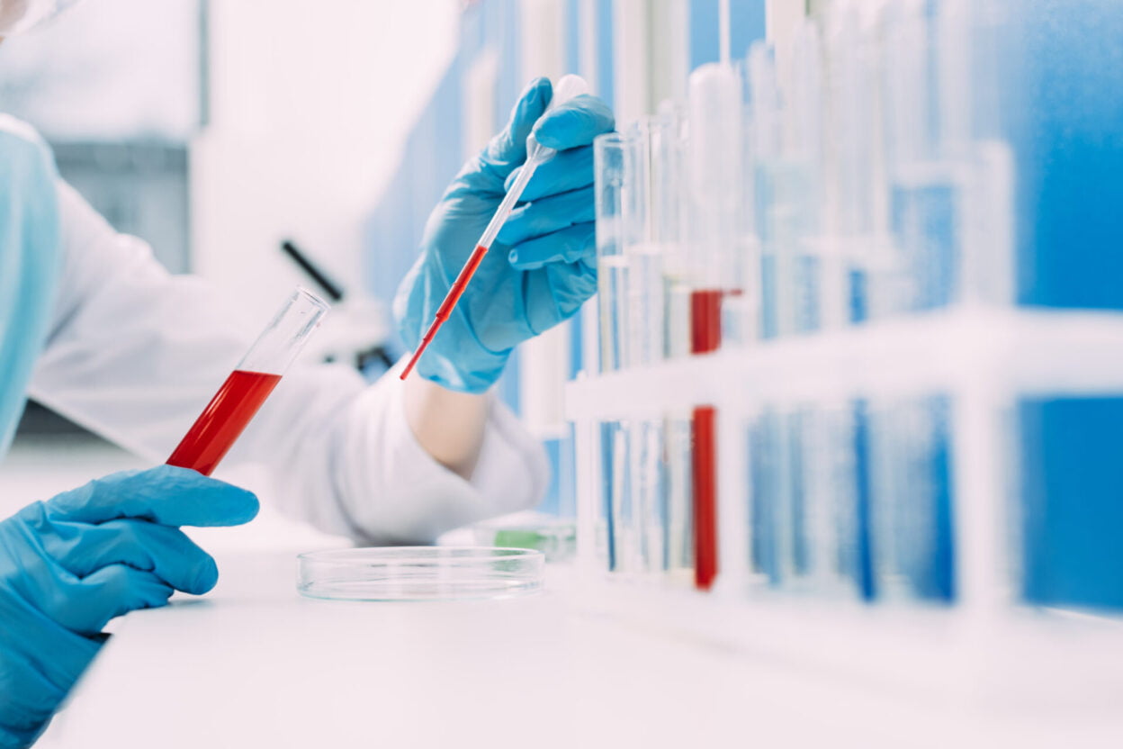 Test Your Blood For PFAS "Forever Chemicals" At Home